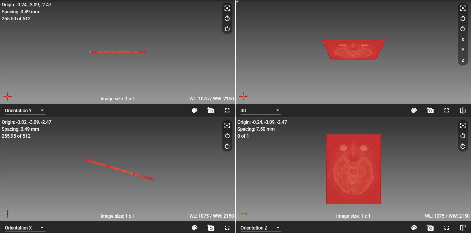 Orientation of slices in the 2D views · Issue #463 · Kitware/glance · GitHub