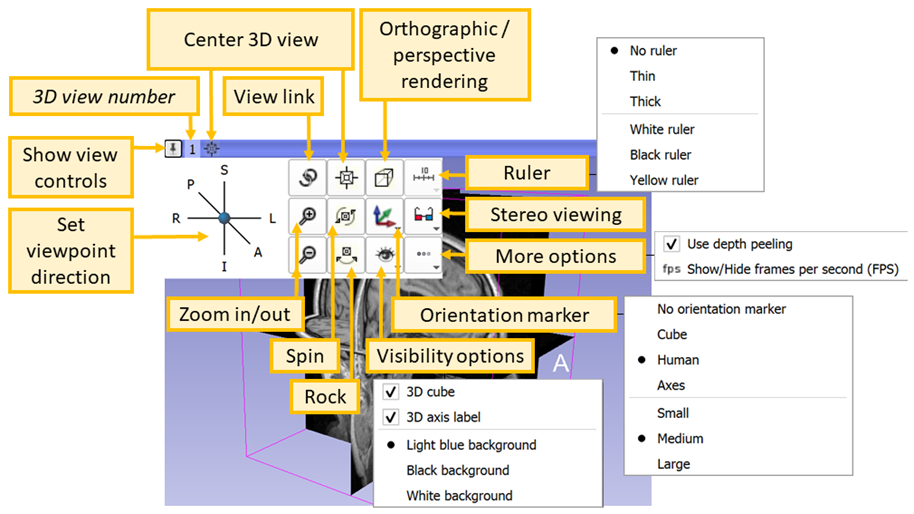 sparc_microct/exercise_1.md at main · castuofa/sparc_microct · GitHub
