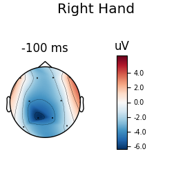 plotting: topomap electrode positions change depending on number of ...