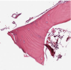 GitHub - Subliminated/Cancer-Image-recognition