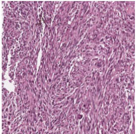 GitHub - Subliminated/Cancer-Image-recognition