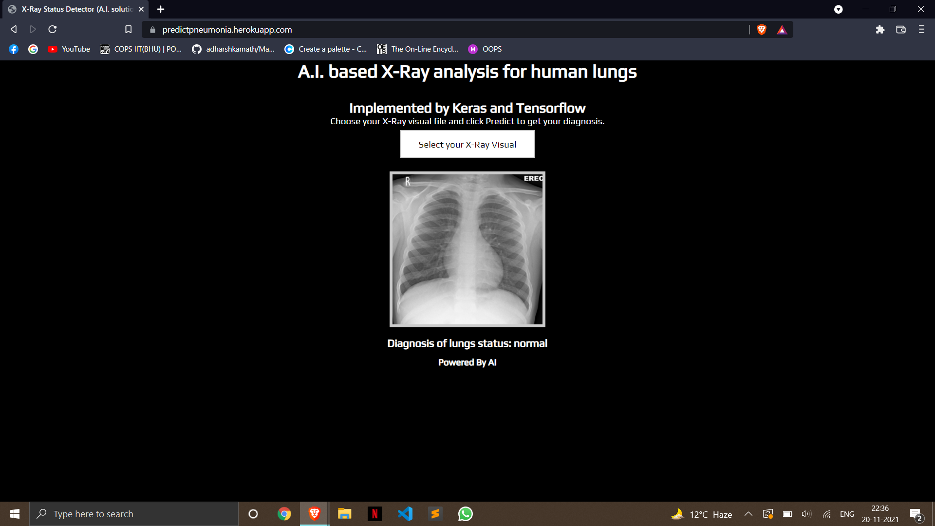 GitHub - amogh-08/Pneumonia-Detection