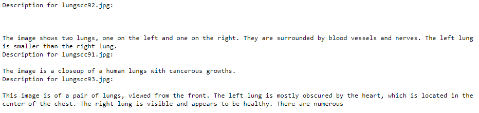 GitHub - Jsujanchowdary/-Lung-Cancer-Detection-using-Convolutional-Neural-Network-and-Open-Ai