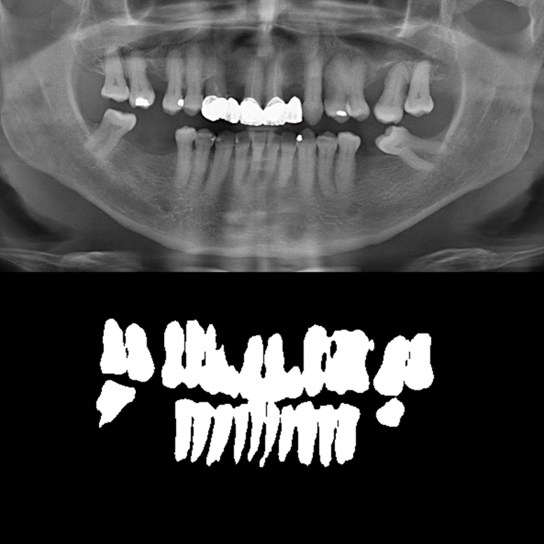 Github Abcnuttersegmentationweb 🍎 This Project Is A Backend Algorithm Framework For Two