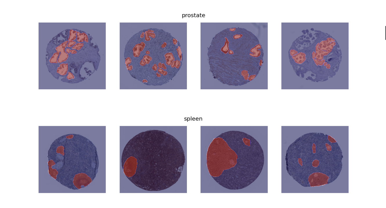 GitHub - atndan/HuBMAP-HPA---Hacking-the-Human-Body GitHub - atndan/HuBMAP-HPA---Hacking-the-Human-Body