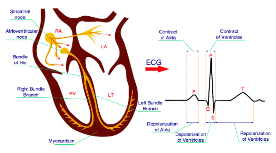 GitHub - elahesalari/Recurrent-Neural-Networks-RNN-: Detection and ...