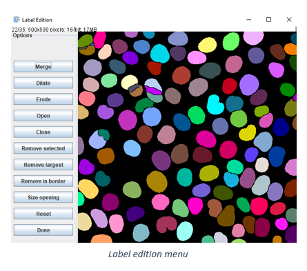 GitHub - prubiocosta/3D-cell-segmentation-with-ImageJ