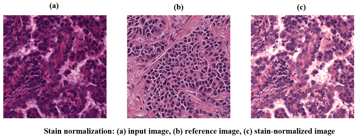 GitHub - amin-sj/nuclei-segmentation: nuclei segmentation using deep learning