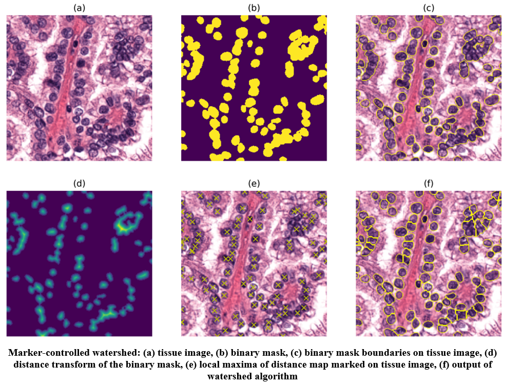 GitHub - amin-sj/nuclei-segmentation: nuclei segmentation using deep learning