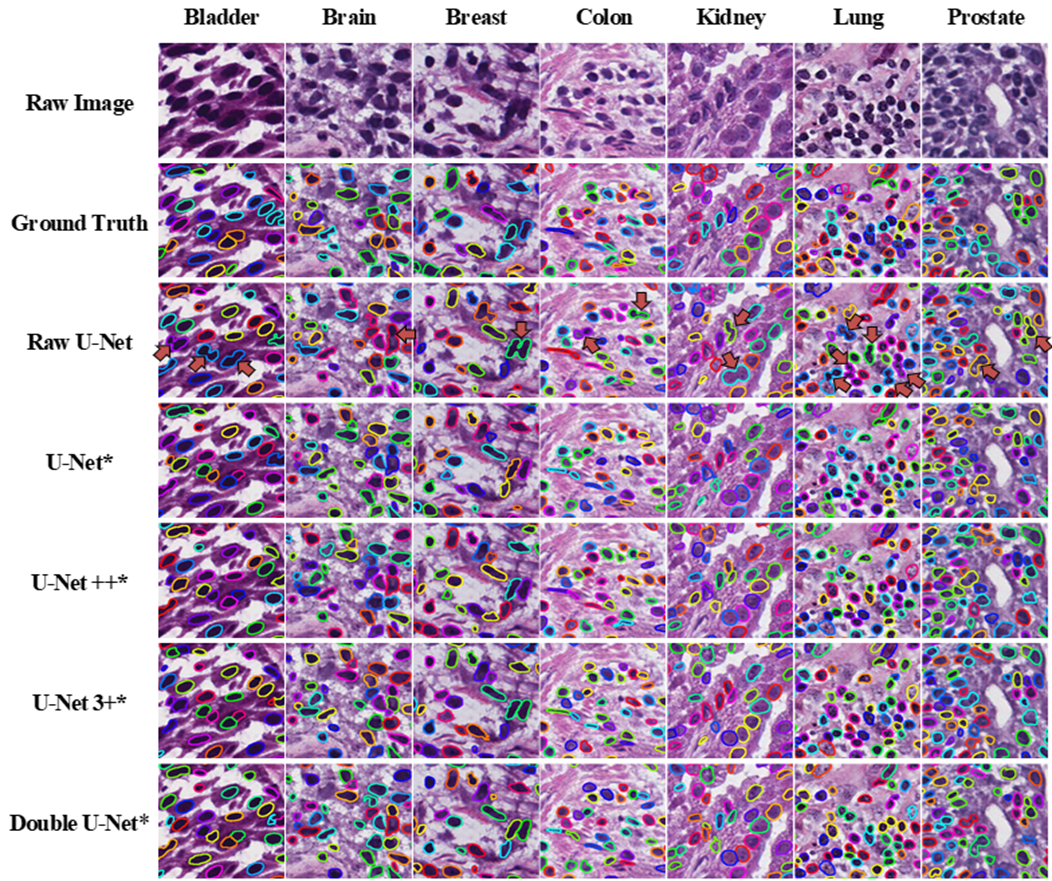 GitHub - amin-sj/nuclei-segmentation: nuclei segmentation using deep learning