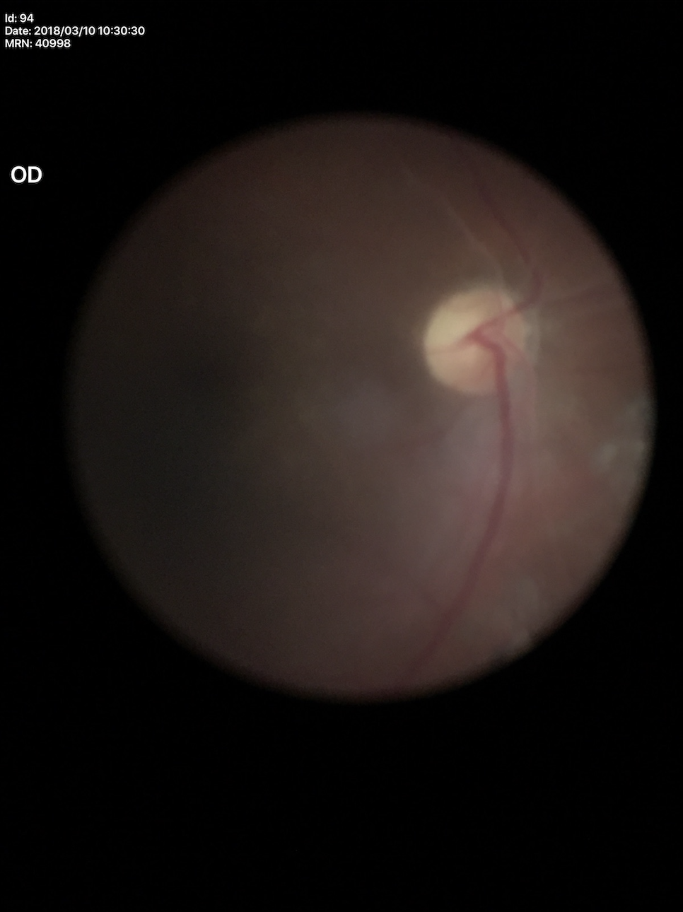 GitHub - magichampz/retinal-image-processing: Image processing of ...