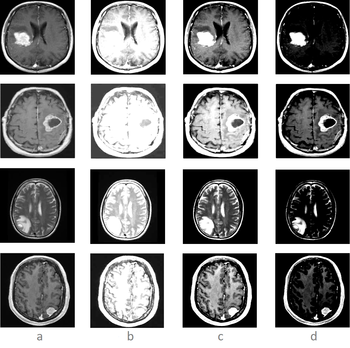 GitHub - zahrakhoshdel/brain-tumour-detection-and-classification ...