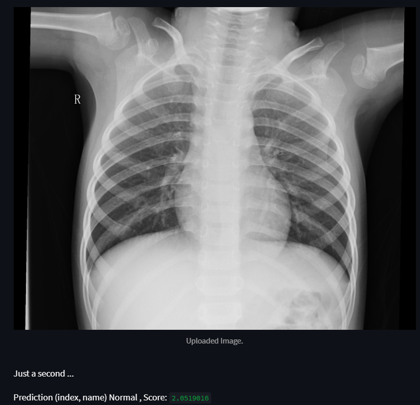 GitHub - asphytheghoul/pneumonia-detector