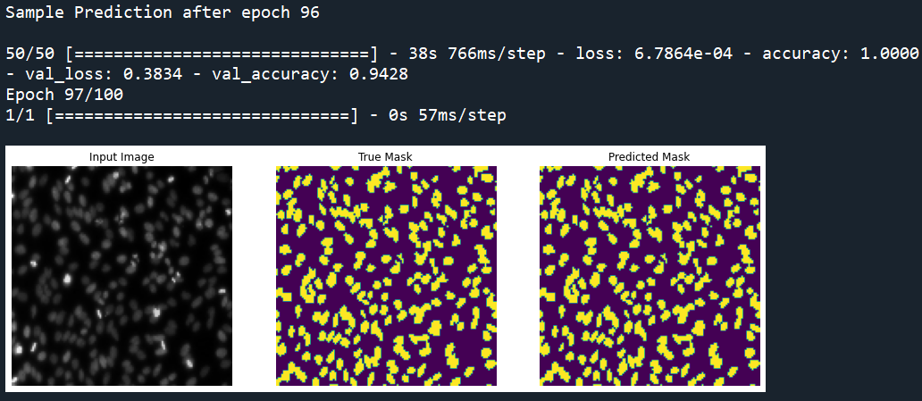 GitHub - athila-razali/project4-ai07: AI07 - Cell Nuclei Segmentation