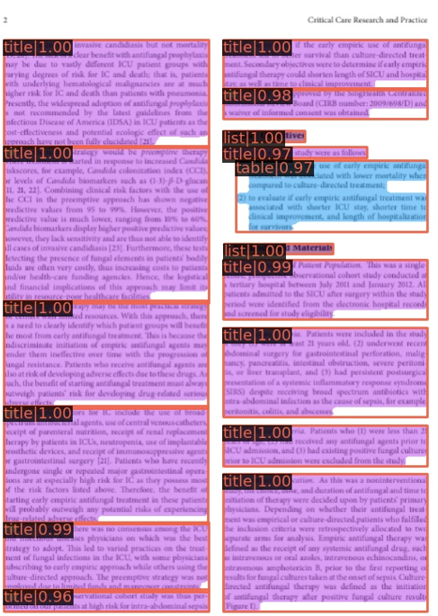 VSR测试时可视化报错 · Issue #63 · hikopensource/DAVAR-Lab-OCR · GitHub