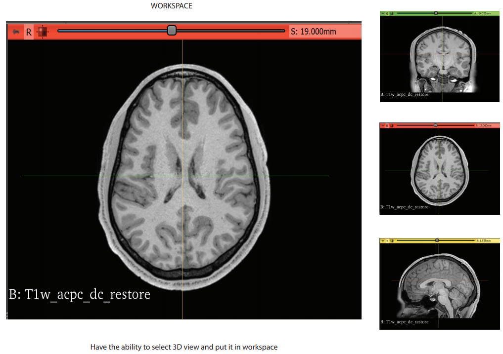 Streamline segmentation interface · Issue #2 · HOA-2/SlicerNeuroSegmentation · GitHub