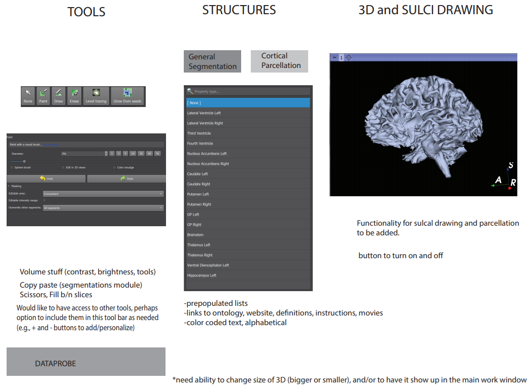 Streamline segmentation interface · Issue #2 · HOA-2/SlicerNeuroSegmentation · GitHub