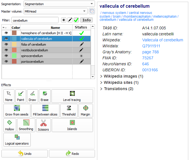 Streamline segmentation interface · Issue #2 · HOA-2/SlicerNeuroSegmentation · GitHub