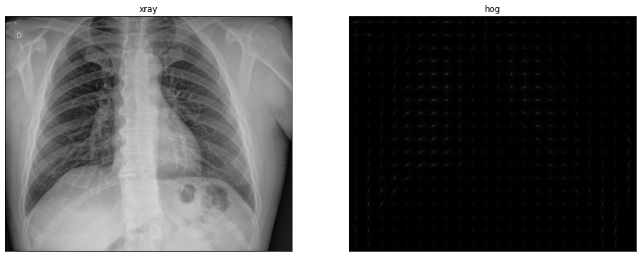 GitHub - SGPracing/Project_Xray_UNIFESP