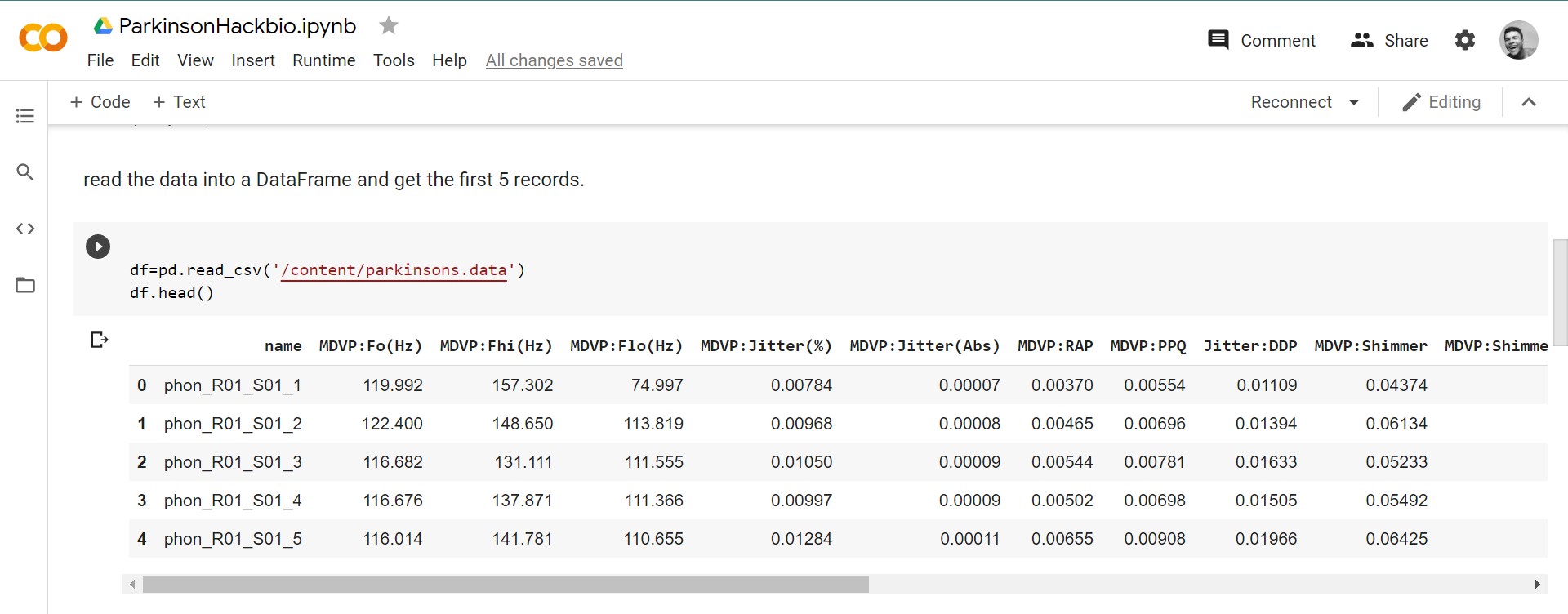 GitHub - Sammyspeed75/Stage-2-Parkinsons