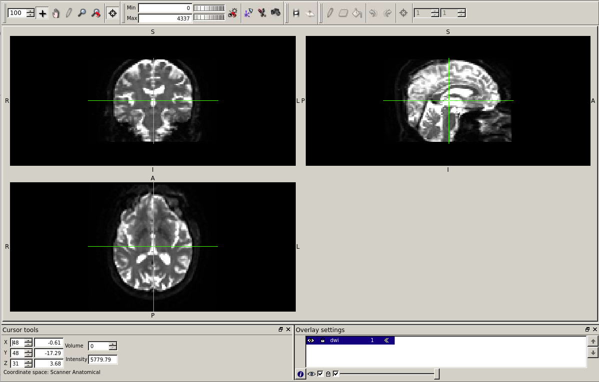 Upgrading to mrtrix3 3.0.2 · Issue #13 · brainlife/app-mrtrix3-preproc · GitHub