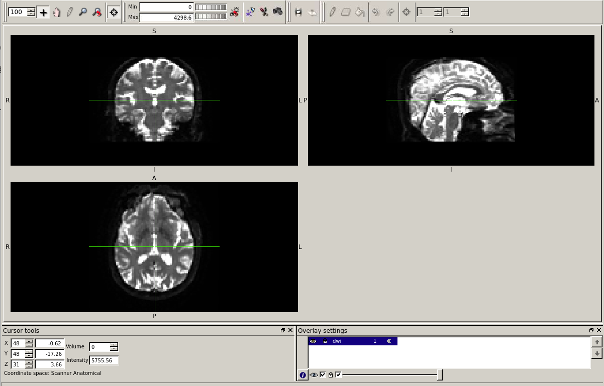 Upgrading to mrtrix3 3.0.2 · Issue #13 · brainlife/app-mrtrix3-preproc · GitHub