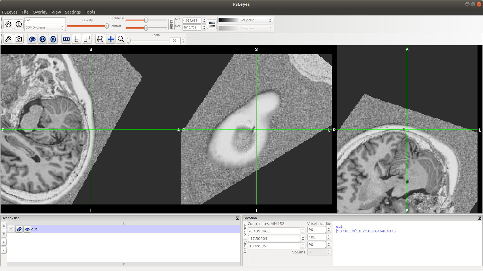 Not working with MPI-Kepzig dataset · Issue #1 · brainlife/app-hcp-acpc-alignment · GitHub