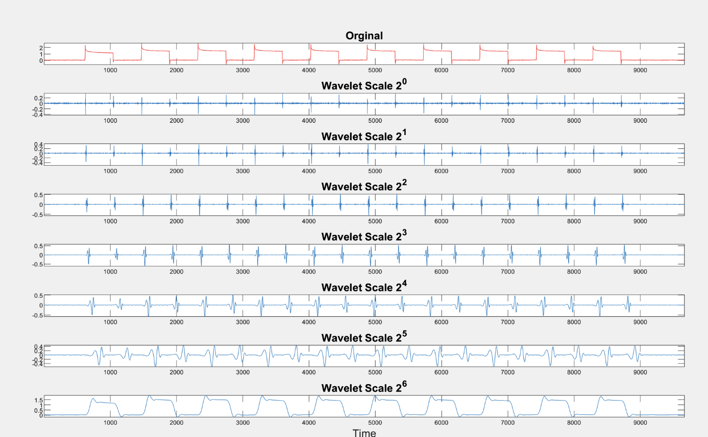 GitHub - ab4821/Abnormality-Detection-for-Capsule-Endoscope: The following code uses the wavelet ...