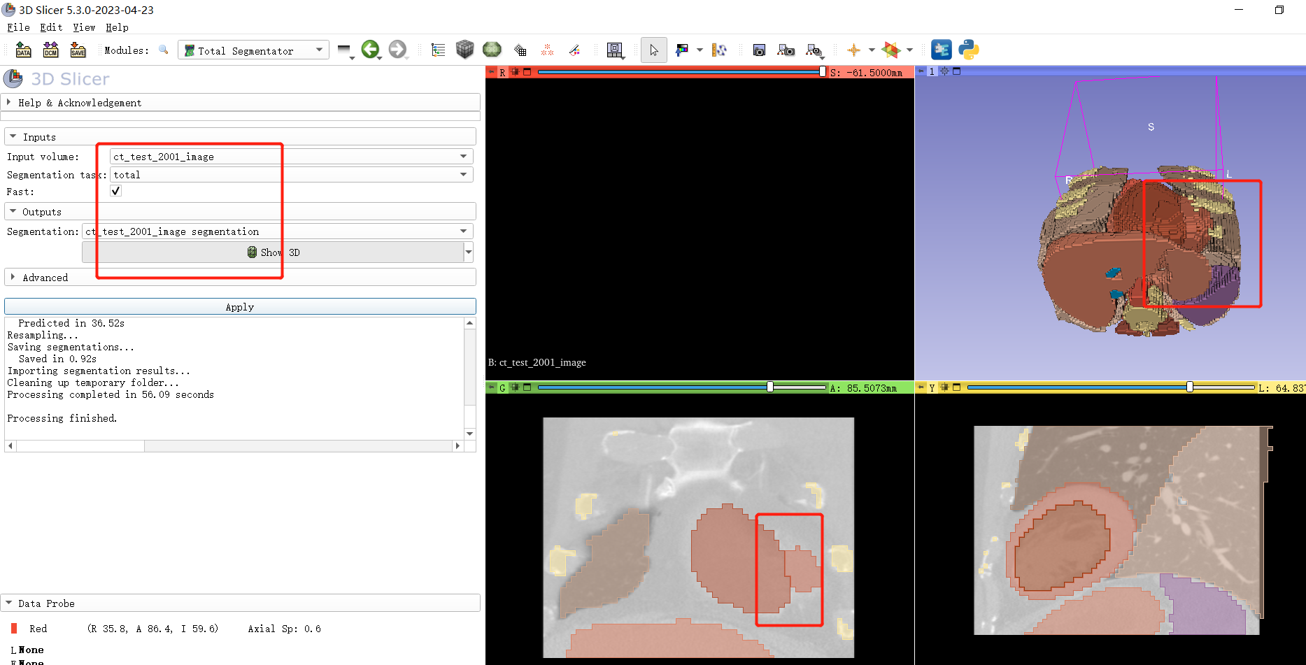 what is the proble with it? · Issue #113 · wasserth/TotalSegmentator ...