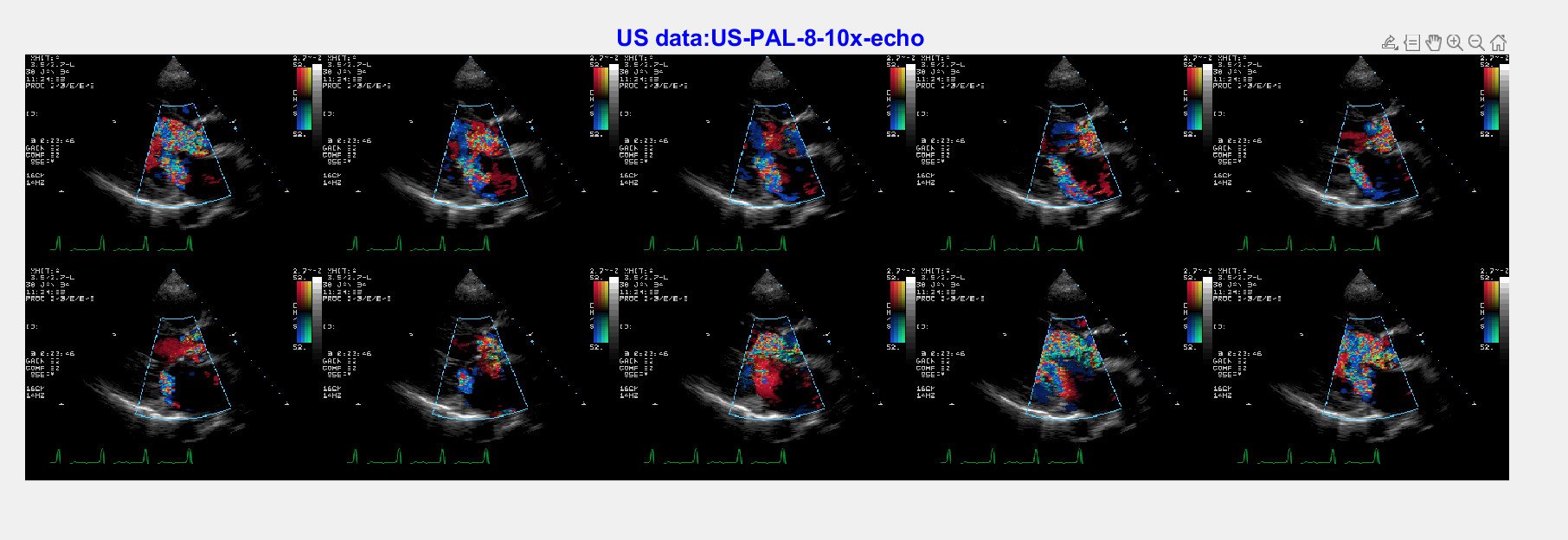 Github Sam291998dicom Image Matlab Read Dicom Image Display Meta 1796