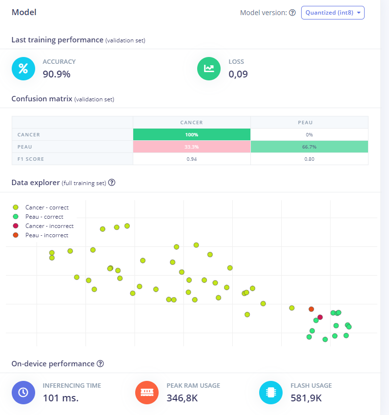 GitHub - Ludovx/TinyML_Projet_final