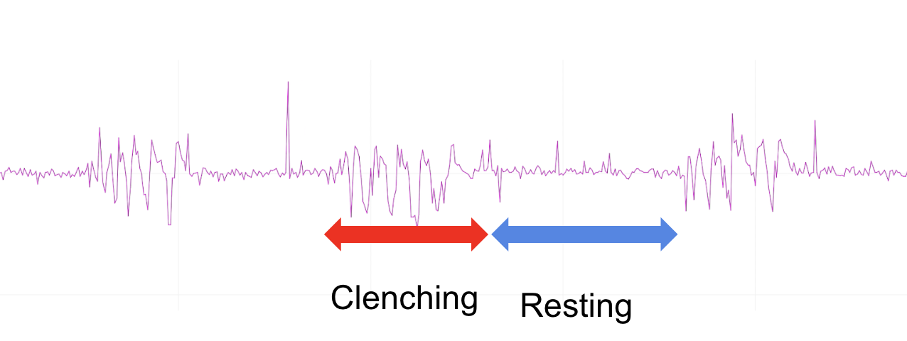 GitHub - JinRhim/Electromyography_Arduino