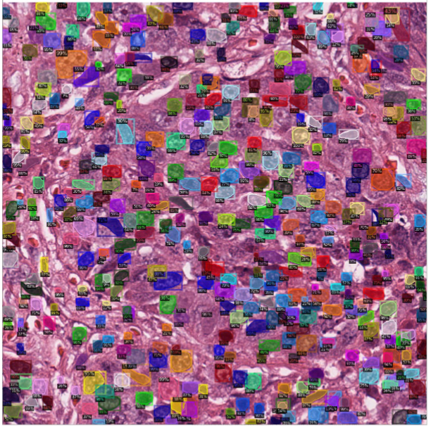 Github Ychung1998instance Segmentaion Vrdl Assignment For Instance Segmentation 4238
