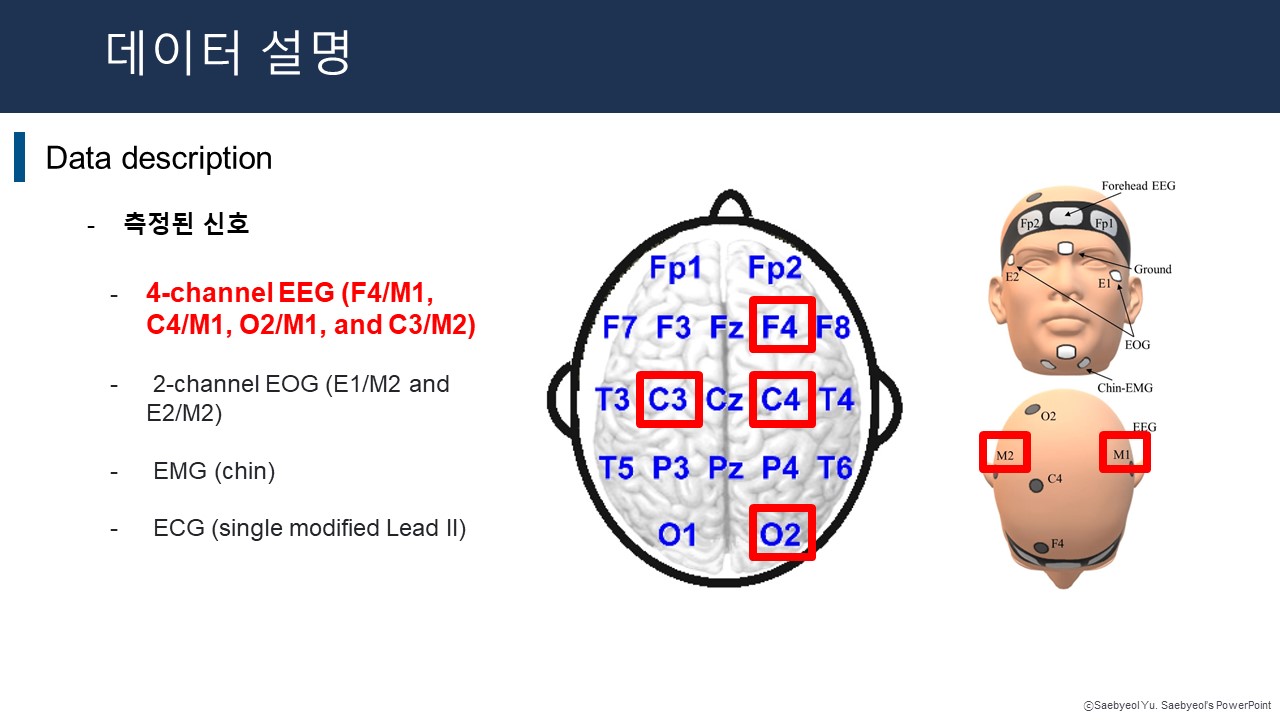 GitHub - MuHyeonSon/BME_Capstone_Design: BME(Biomedical Engineering) capstone design source code.