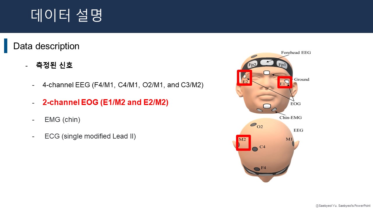 GitHub - MuHyeonSon/BME_Capstone_Design: BME(Biomedical Engineering) capstone design source code.