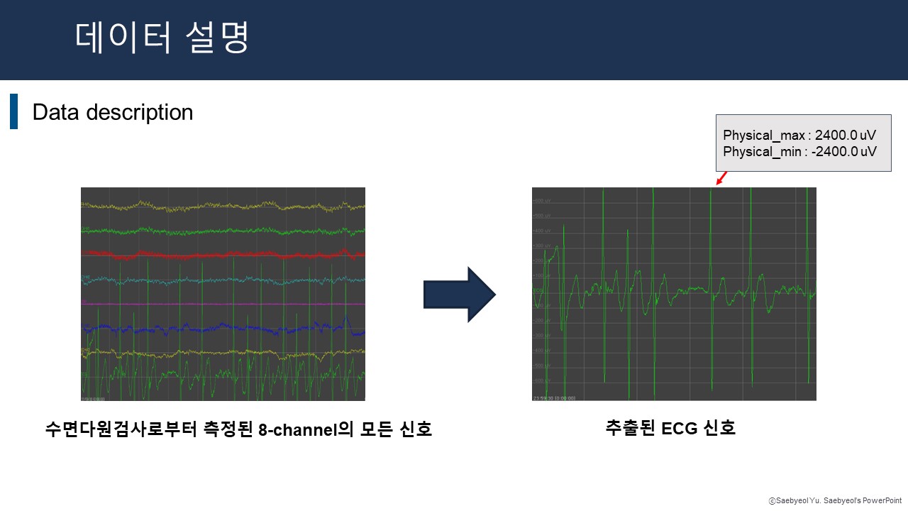 GitHub - MuHyeonSon/BME_Capstone_Design: BME(Biomedical Engineering) capstone design source code.