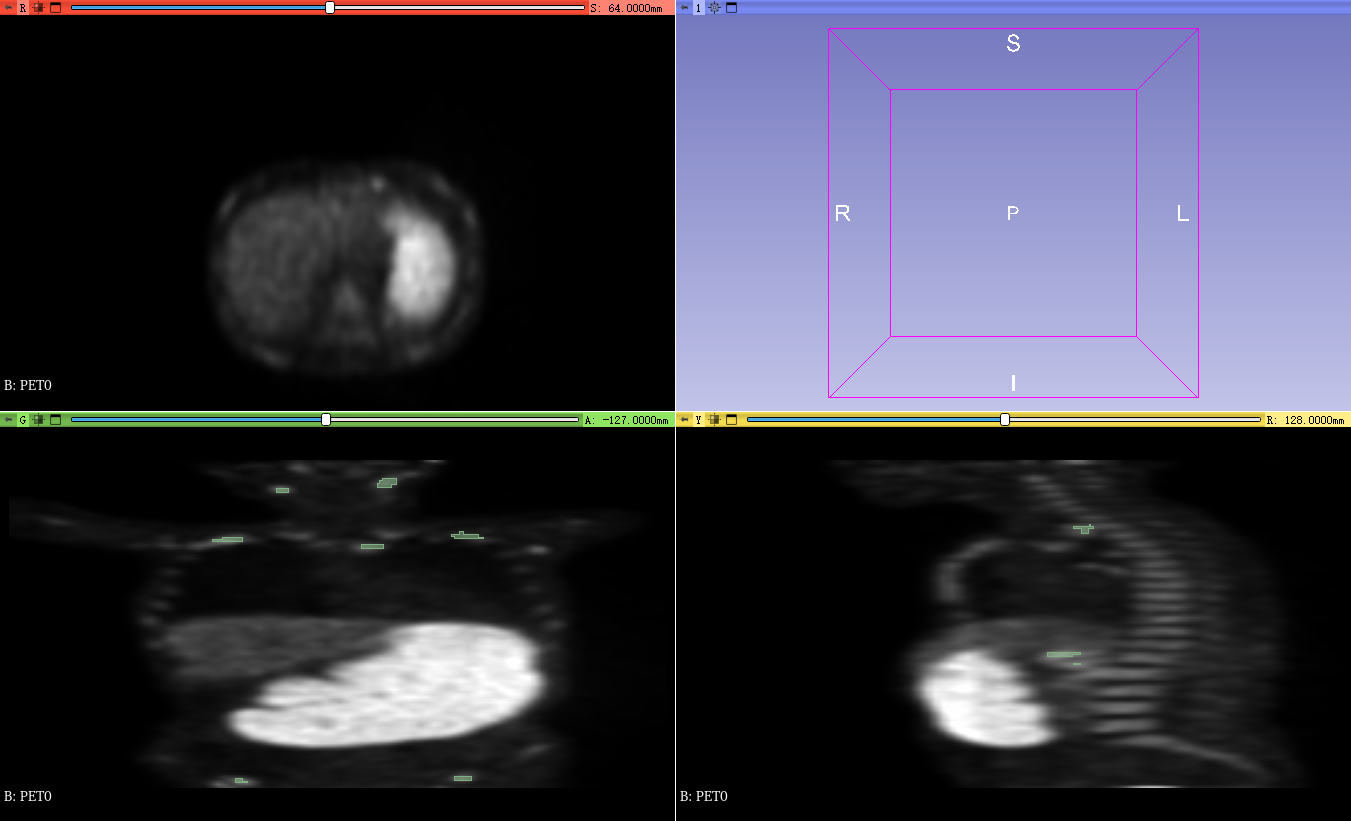 ImportError: cannot import name 'UNet_ENN' from 'monai.networks.nets' · Issue #1 · heudiasyc ...