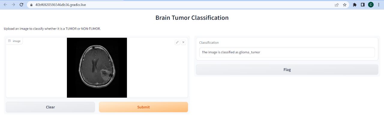 GitHub - SrinikaSharma/BrainTumorClassification