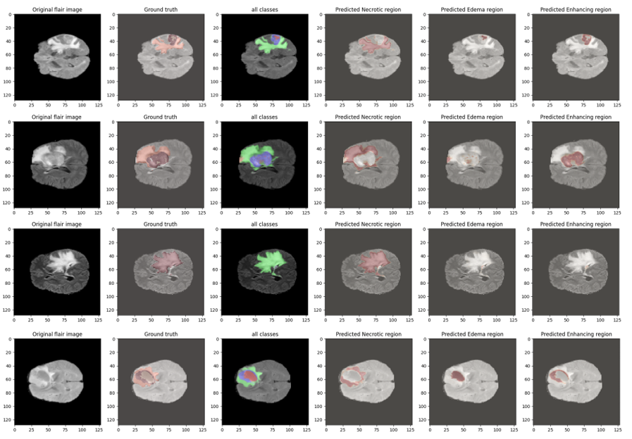 GitHub - VegardEikenes/Brain-Tumor-Segmentation-with-CNN