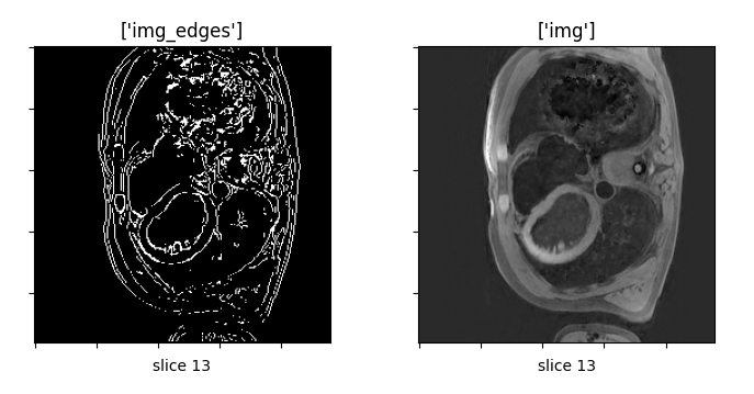 GitHub - IlvaHou55/canny_edge_detector_3D: Perform Canny edge detection ...