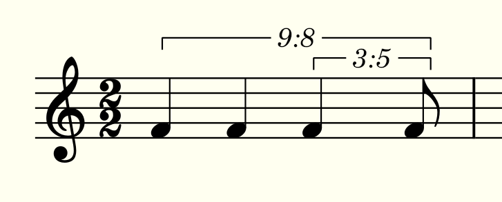 Necessary improvements on the UI of tuplets · Issue #18980 · musescore/MuseScore · GitHub