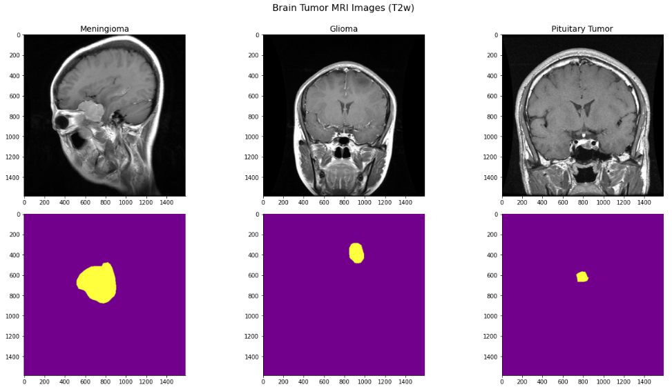 GitHub - Oumaimabel/Brain-Tumor-Classification