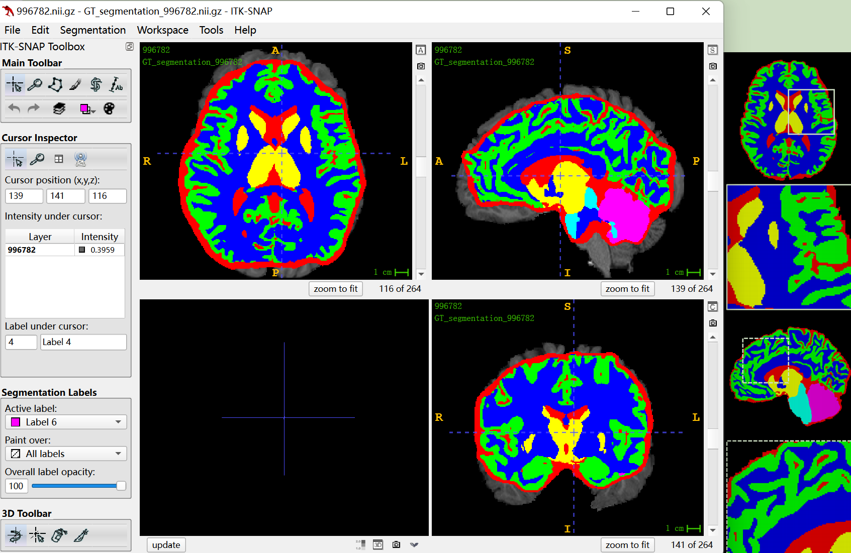 Hi，I encounter one problem about using antspynet.utilities.deep_atropos ! · Issue #84 · ANTsX ...
