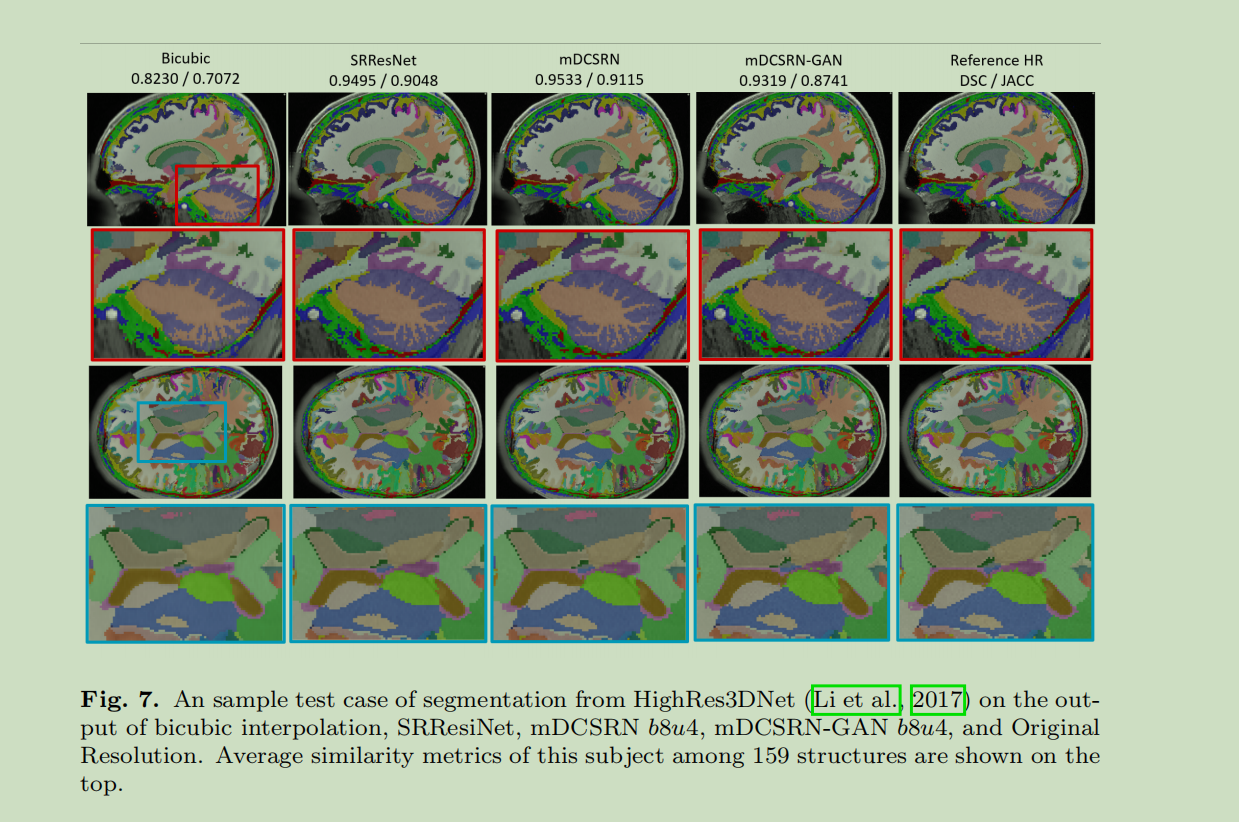 There is a promble about segmentation on unprocessed HCP (320×320×256 ...