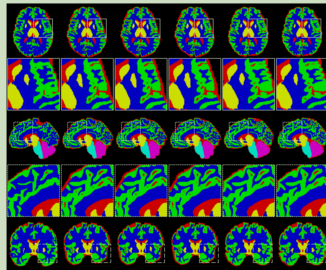 Hi，I encounter one problem about using antspynet.utilities.deep_atropos ! · Issue #84 · ANTsX ...