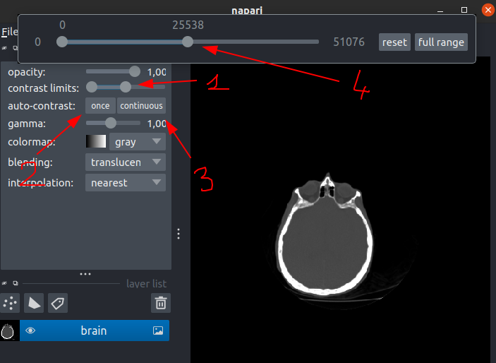 Adjust contrast · Issue #1 · LaboratoryOpticsBiosciences/napari-brainbow-diagnose · GitHub