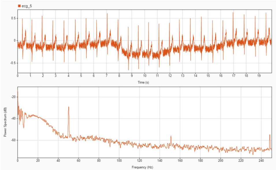 GitHub - asadian98/ECG_Classification: ECG Classification, Intro ...