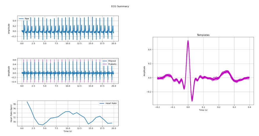 GitHub - asadian98/ECG_Classification: ECG Classification, Intro ...