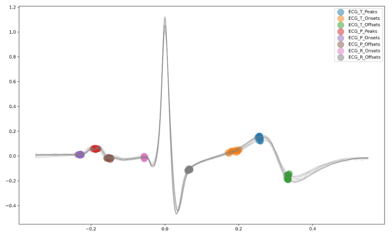 GitHub - asadian98/ECG_Classification: ECG Classification, Intro ...