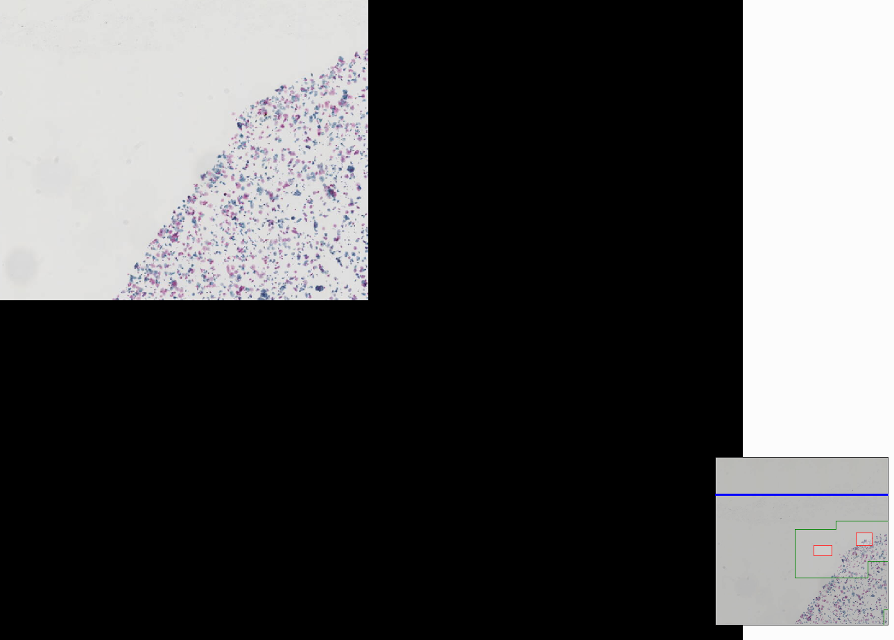 Tiff file display weird · Issue #223 · computationalpathologygroup/ASAP ...